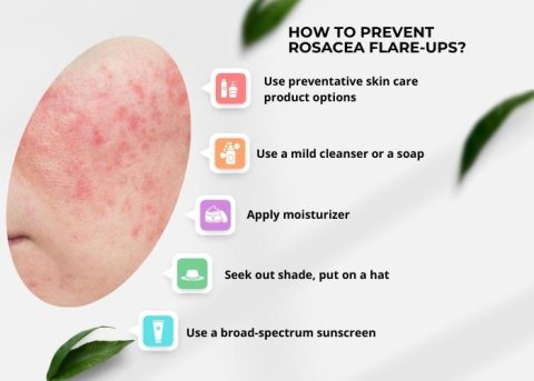 Understanding The Main Causes of Rosacea Flare-Ups